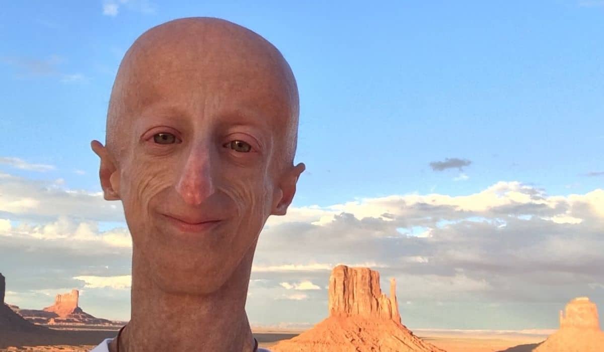 Sammy Basso, già raccolte migliaia di firme per la beatificazione ...